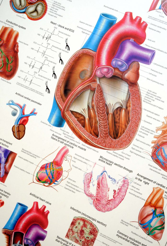 Cardioversion - Riverina Cardiology
