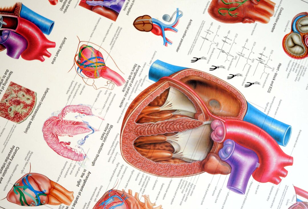 CT Calcium Score and CT Coronary Angiogram (CTCA) - Riverina Cardiology